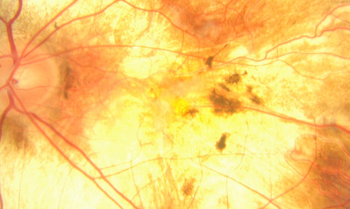 The Longest Shortest Time